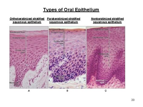 Oral Mucosa Part 1 1 Oral Mucosa Mucous