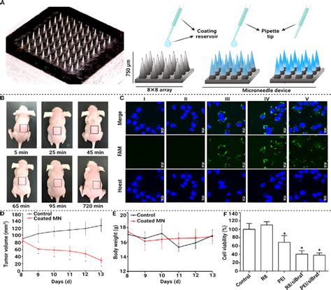 Schematic Representation Of Coated MNs And Its Skin Anti Melanoma