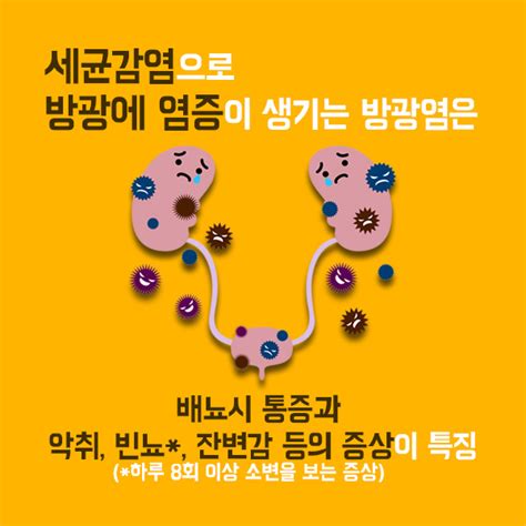 아이플러스 후기와 건강정보 방광염오줌소태