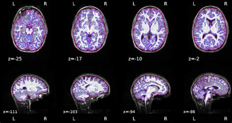 brainprep