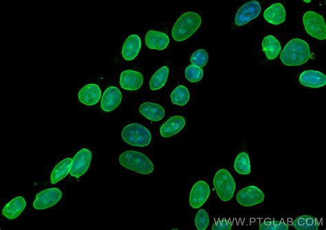 Lamin Ac Antibody Cl488 81042 Proteintech