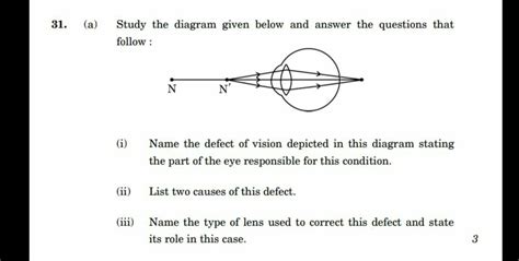 A Study The Diagram Given Below And Answer The Questions That Follow
