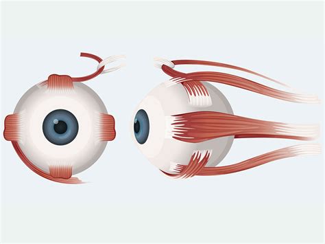 Strabismus Surgery For Misaligned Eyes Crossed Eyes Or Wall Eyes