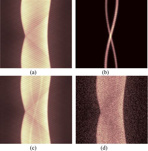 The 2d Sinograms A The Summed Body Phantom Sinogram B The Summed