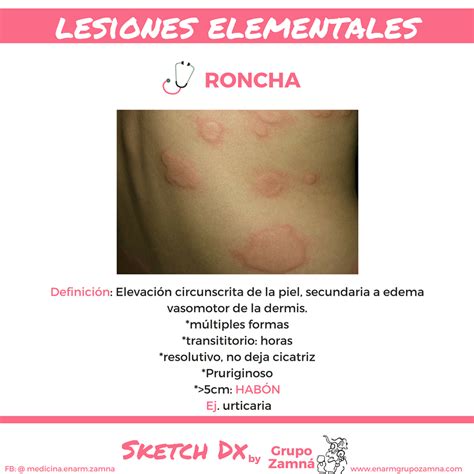 Roncha