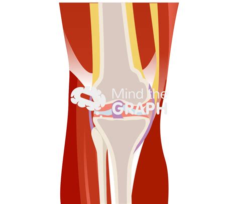 Knee Front View