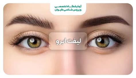 لیفت ابرو چیست؟ انواع، روش و قیمت لیفت ابرو