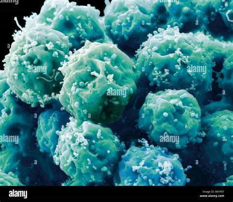 Embryonic Stem Cells Escs Coloured Scanningelectron Micrograph Sem