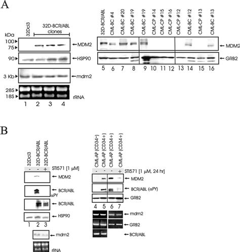 Figure 2 From Bcrabl Activates Mdm2 Mrna Translation Via The La Antigen Semantic Scholar