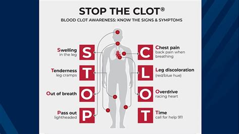 What Are Warning Signs Of Blood Clot At Grady Naylor Blog