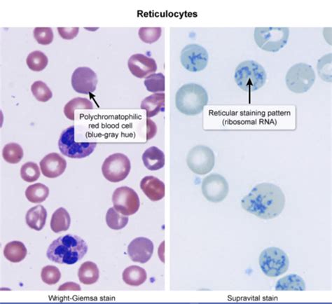 Set 28 Flashcards Quizlet