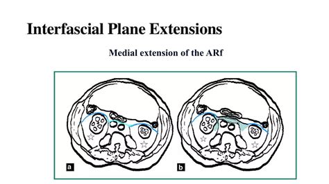 Radioanatomy Of Retroperitoneal Space Ppt