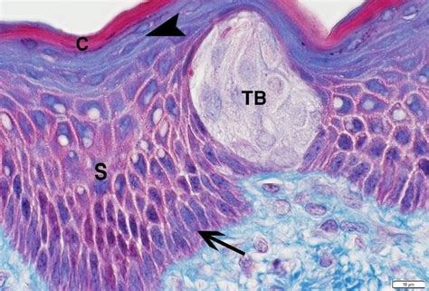 Photomicrograph Of The Vallate Papilla Showing The Layers Of The