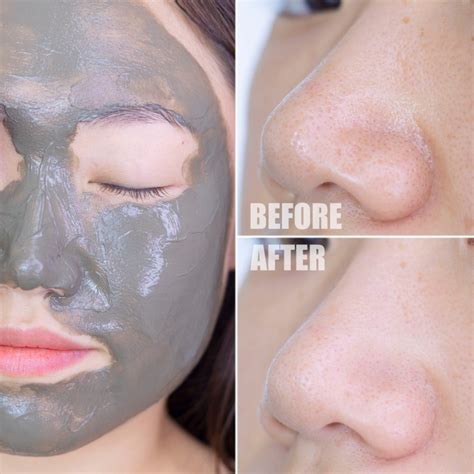 피부 모공 줄이는법 올리브영 모공팩 추천 비알머드 보령머드팩 후기 네이버 블로그