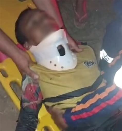 Homem Fratura Perna Em Acidente Entre Duas Motos No Acre Contilnet