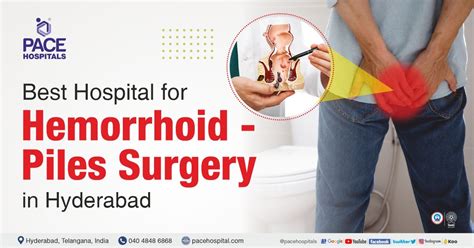 Piles Surgery In Hyderabad Laser Treatment Types Cost Advantages