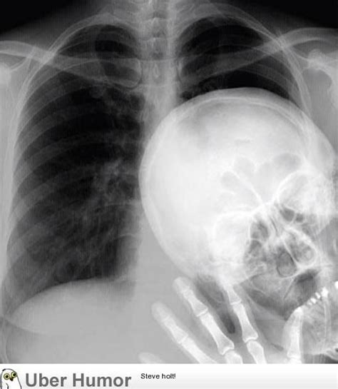 Urgent Care That Does Chest X Rays Snorkelling Vlog Fonction