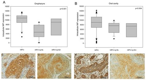 Intracellular Migration Inhibitory Factor Mif Expression In Head And