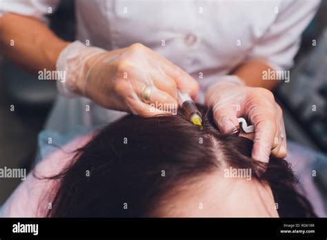 Platelet Rich Plasma Injection Procedure Hair Growth Stimulation Prp
