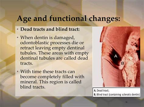 Dentin Pptx