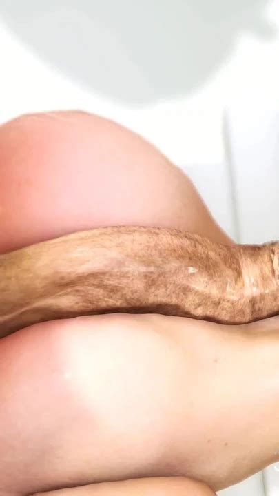 Die Porno Videos In Der Kategorie Chirurgie Xhamster