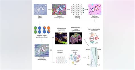 Johns Hopkins Researchers Identify Key Markers In Pancreatic Cancer