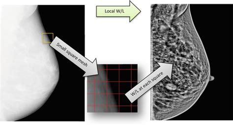 Image Interpolation Radiology Key