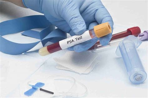 Can You Reduce Your Psa Levels