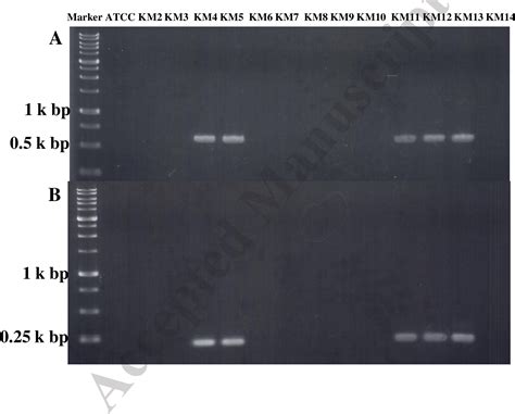 Genetic Diversity In Streptococcus Dysgalactiae Subsp Equisimilis