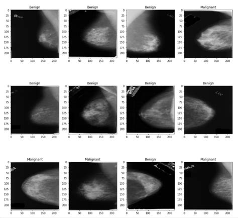 Github Numinousmuses Mammocad Cnn For Tumor Detection In Mammograms