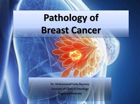 Pathology Of Breast Cancer Pptx
