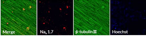 How Can Human Ipsc Derived Sensory Neurons Transform Your Pain Research
