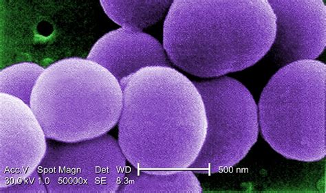 Antibiotic Resistant Staphylococcus Health Mil