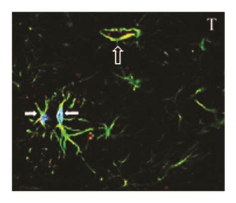 Immunofluorescence Colocalization For Gfap And Aqp4 In The Brain The