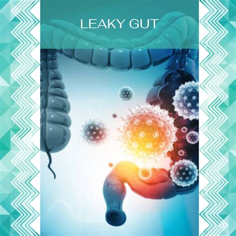 Leaky Gut Syndrome 10 Signs Of Leaky Gut