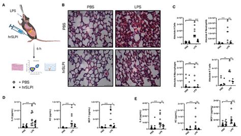 Biomolecules Free Full Text Secretory Leucoprotease Inhibitor SLPI