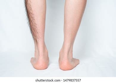 Legs Hair Removal Men Before After Stock Photo Shutterstock