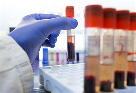 Immulab Abo And Rhd Reagents Anti Human Globulin Reagents Phenotyping
