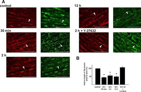 Decreased Glu Tubulin Levels In The Axons After The Spinal Cord Injury