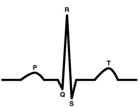 A Typical Ecg Waveform Download Scientific Diagram