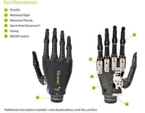 Worlds First App Controlled Prosthetic Hand Allows Natural Functions