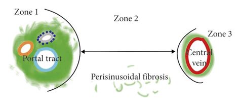 Zonal