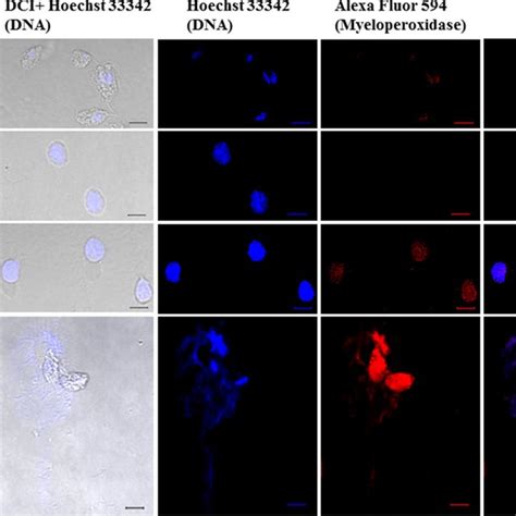 Immune Detection Of Human Myeloperoxidase In Neutrophils And Nets Download Scientific Diagram