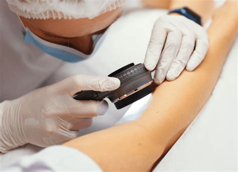 Melanoma Week El Paso A Paso Para Prevenir El Cáncer De Piel Más