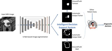 Frontiers Fully Automated Bladder Tumor Segmentation From T2 Mri