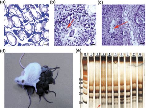 Progenies Generated From Transplantation Of Adult Spermatogonial Stem