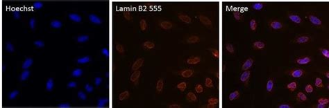 Lamin B2 Monoclonal Antibody E 3 Alexa Fluor™ 555 Invitrogen™ 50 μl