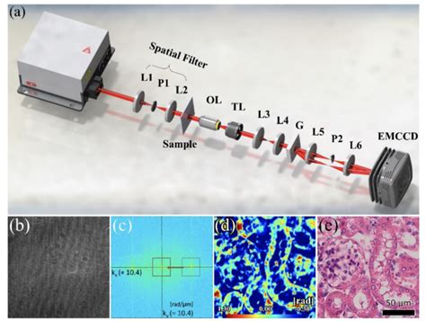Optical Properties Of Acute Kidney Injury Measured By Quantitative