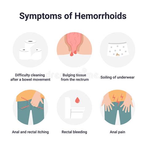Set Symptoms Of Hemorrhoids Stock Vector Illustration Of Internal