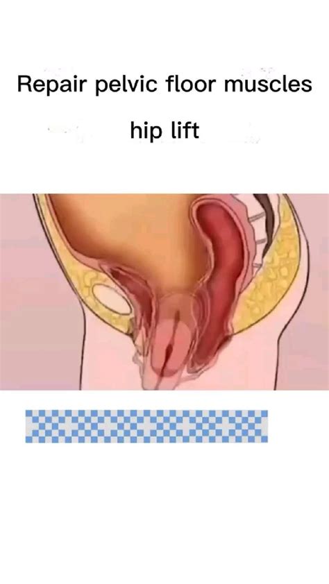 9 Best Exercises For Hip Bursitis Video Included Artofit